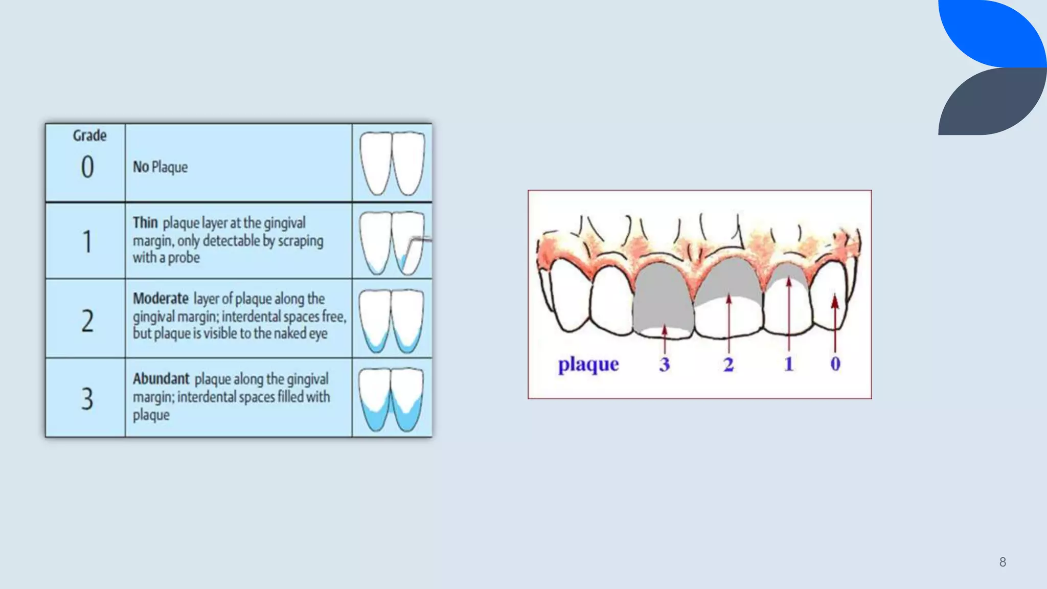 Gingival and Periodontal Indices.pptx