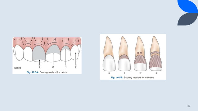 Gingival and Periodontal Indices.pptx | Oral care | Personal Care