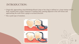 Gingivally approaching clasps/bar clasps | PPTX
