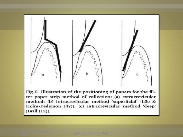 Gingival crevicular fluid