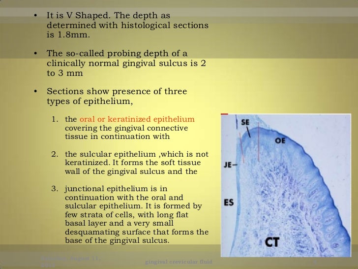 Gingival crevicular fluid