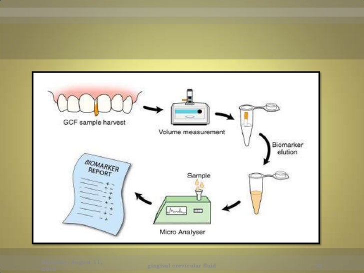 Gingival crevicular fluid