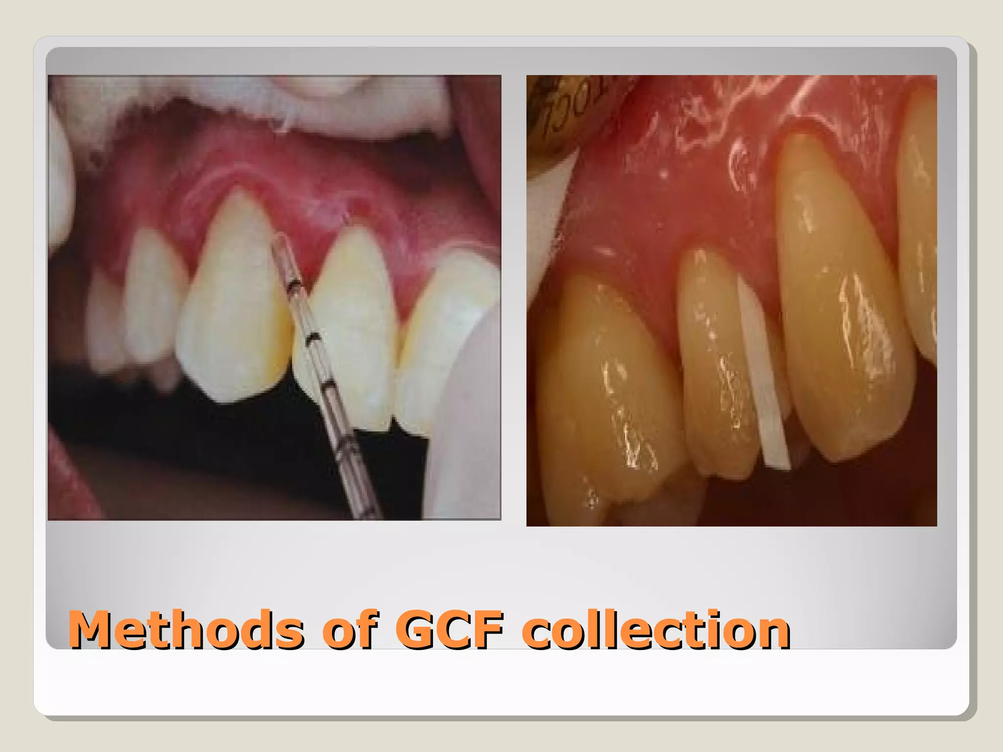 Defence Mechanism of Gingivae | PPT