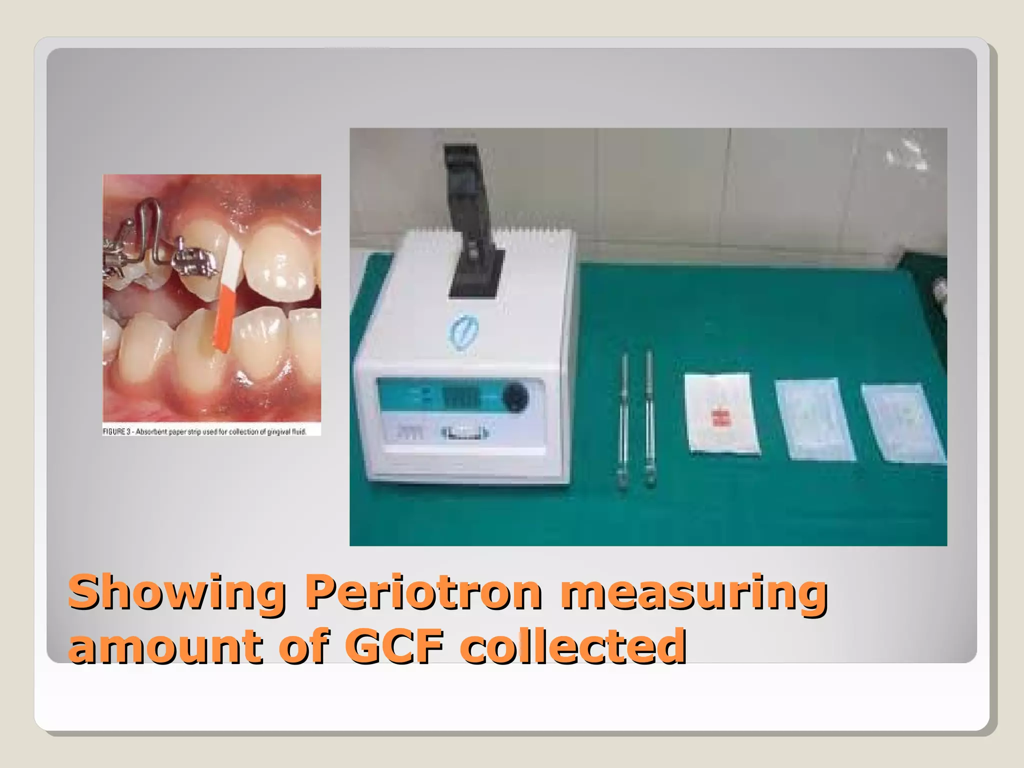Defence Mechanism of Gingivae | PPT