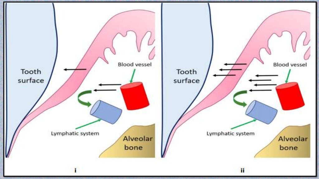 Gingival crevicular fluid