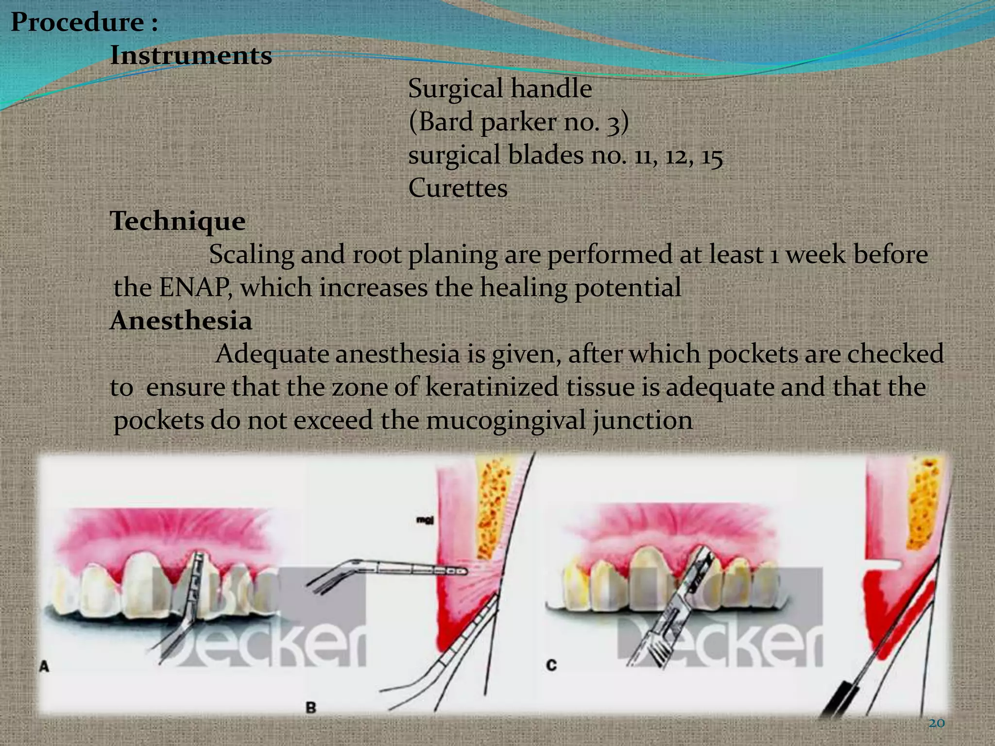 Gingival curettage | PPTX