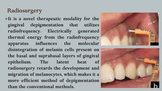 Gingival Depigmentation ............pptx