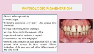 gingival depigmentation part 1-1.pdf