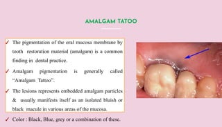 gingival depigmentation part 1-1.pdf