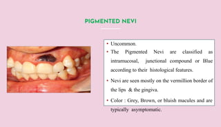 gingival depigmentation part 1-1.pdf