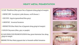 gingival depigmentation part 1-1.pdf