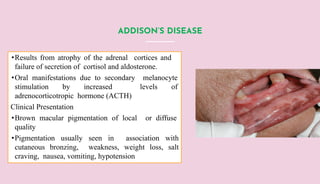 gingival depigmentation part 1-1.pdf