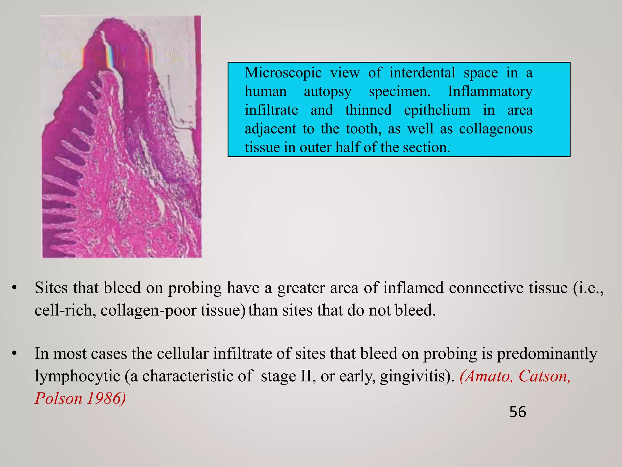 gingival disease...pptx