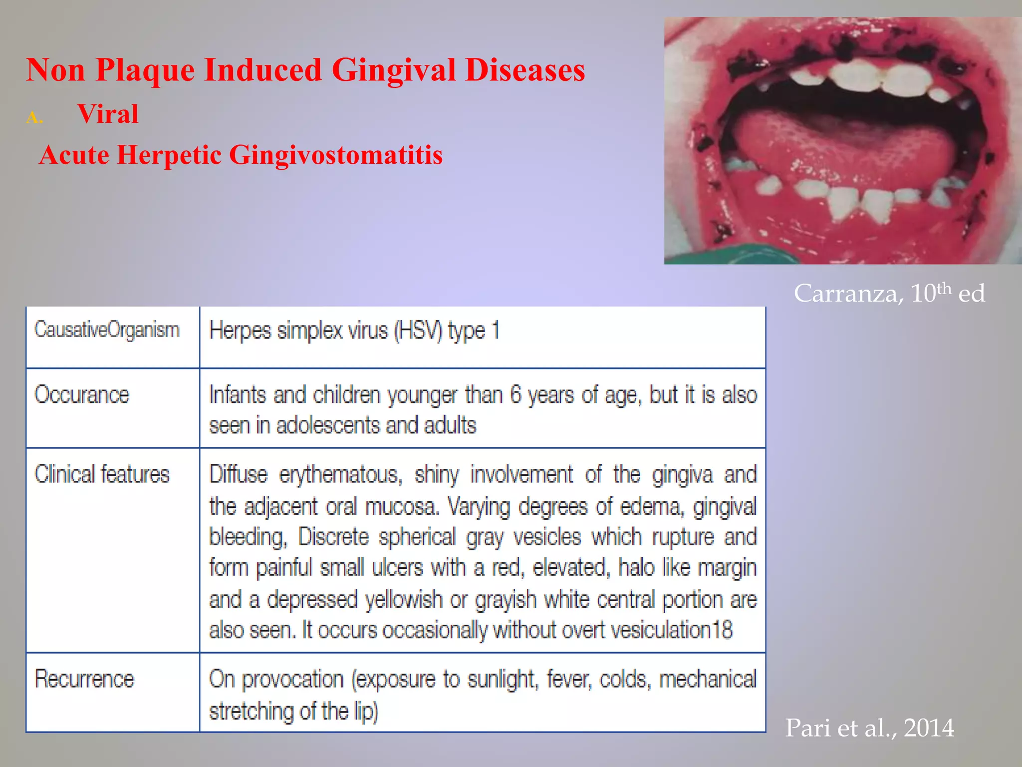 Gingival diseases in children | PPTX