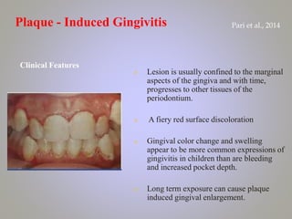 Gingival diseases in children | PPTX
