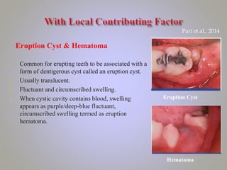 Gingival diseases in children | PPTX