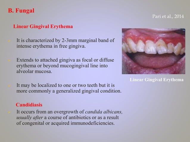 Gingival diseases in children | PPTX