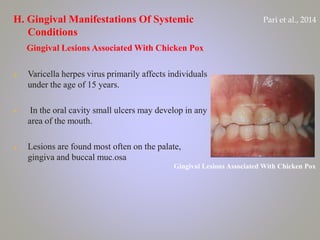 Gingival diseases in children | PPTX