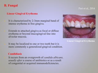 Linear Gingival Erythema