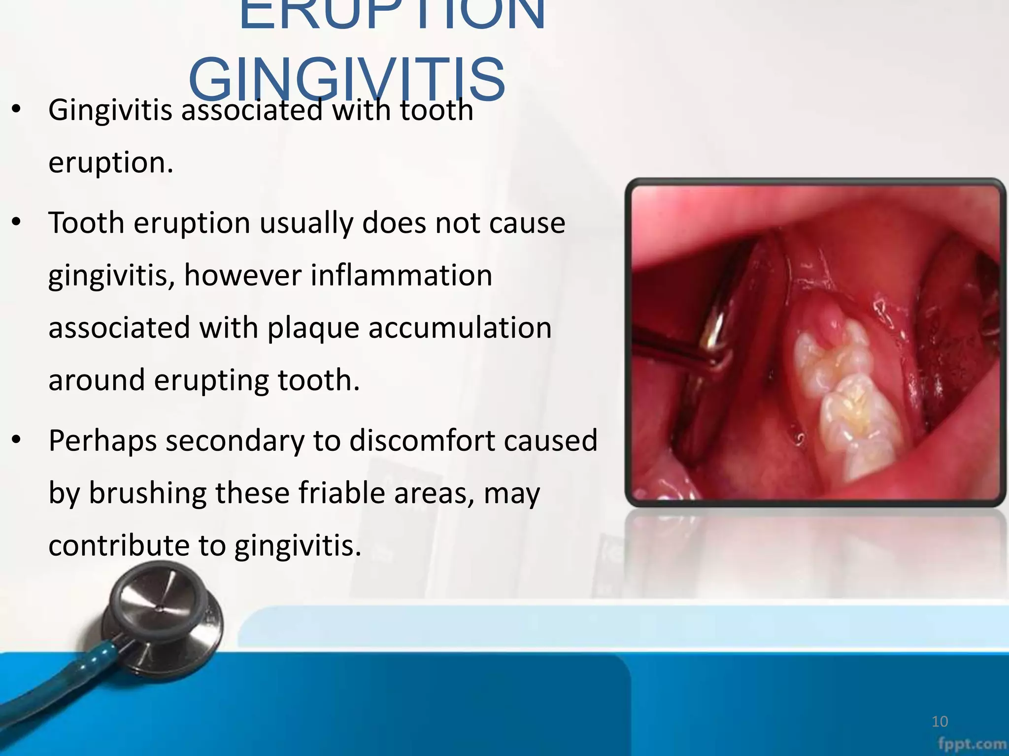 Gingival diseases in children | PPTX