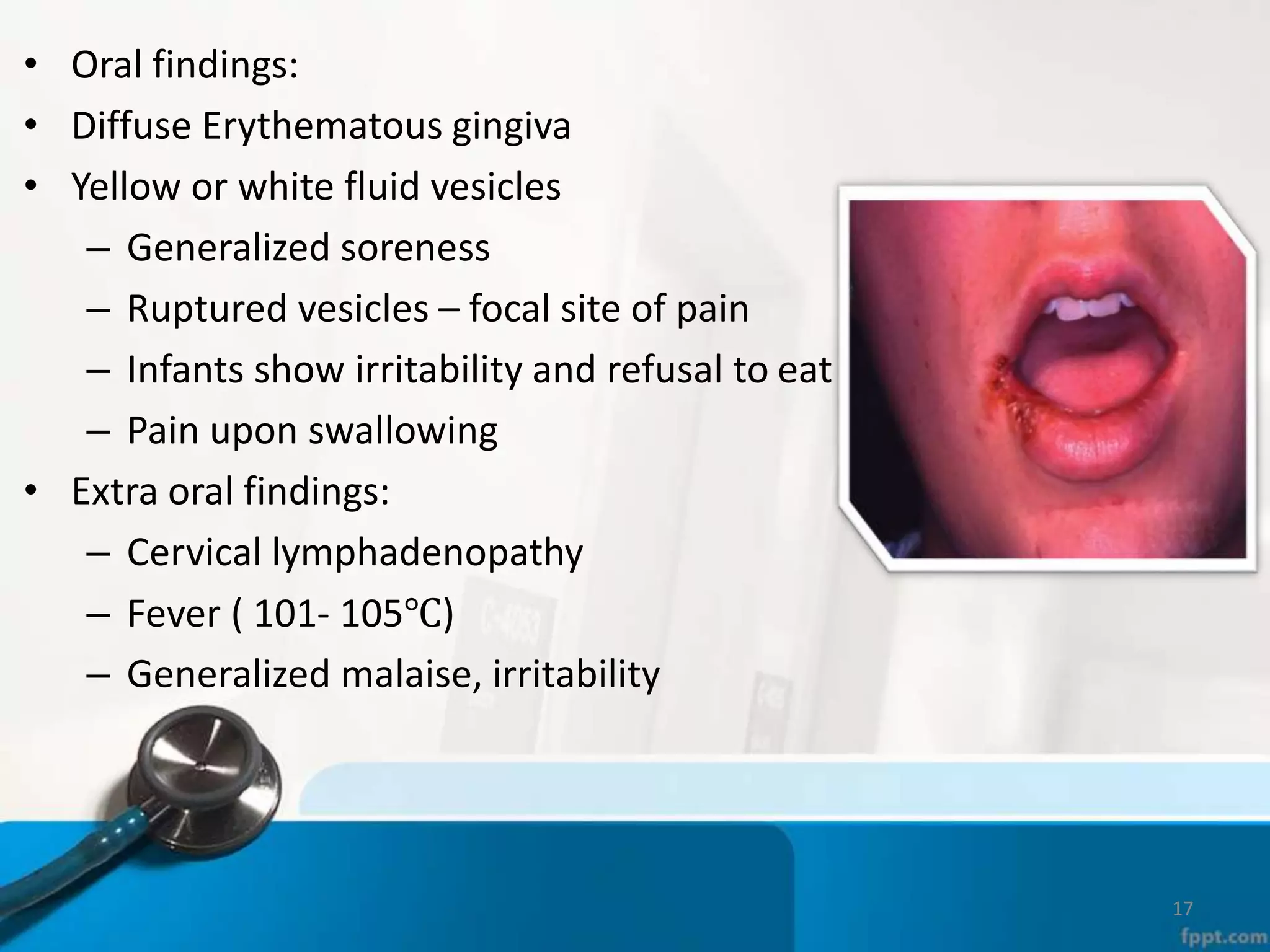 Gingival diseases in children | PPTX