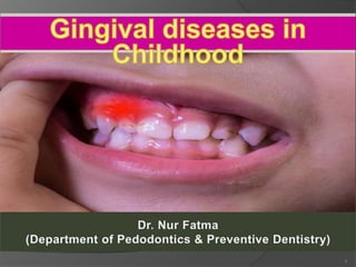Gingival diseases in childhood | PPTX