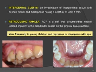 Gingival diseases in childhood | PPTX