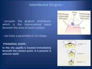 gingiva_lect.ppt