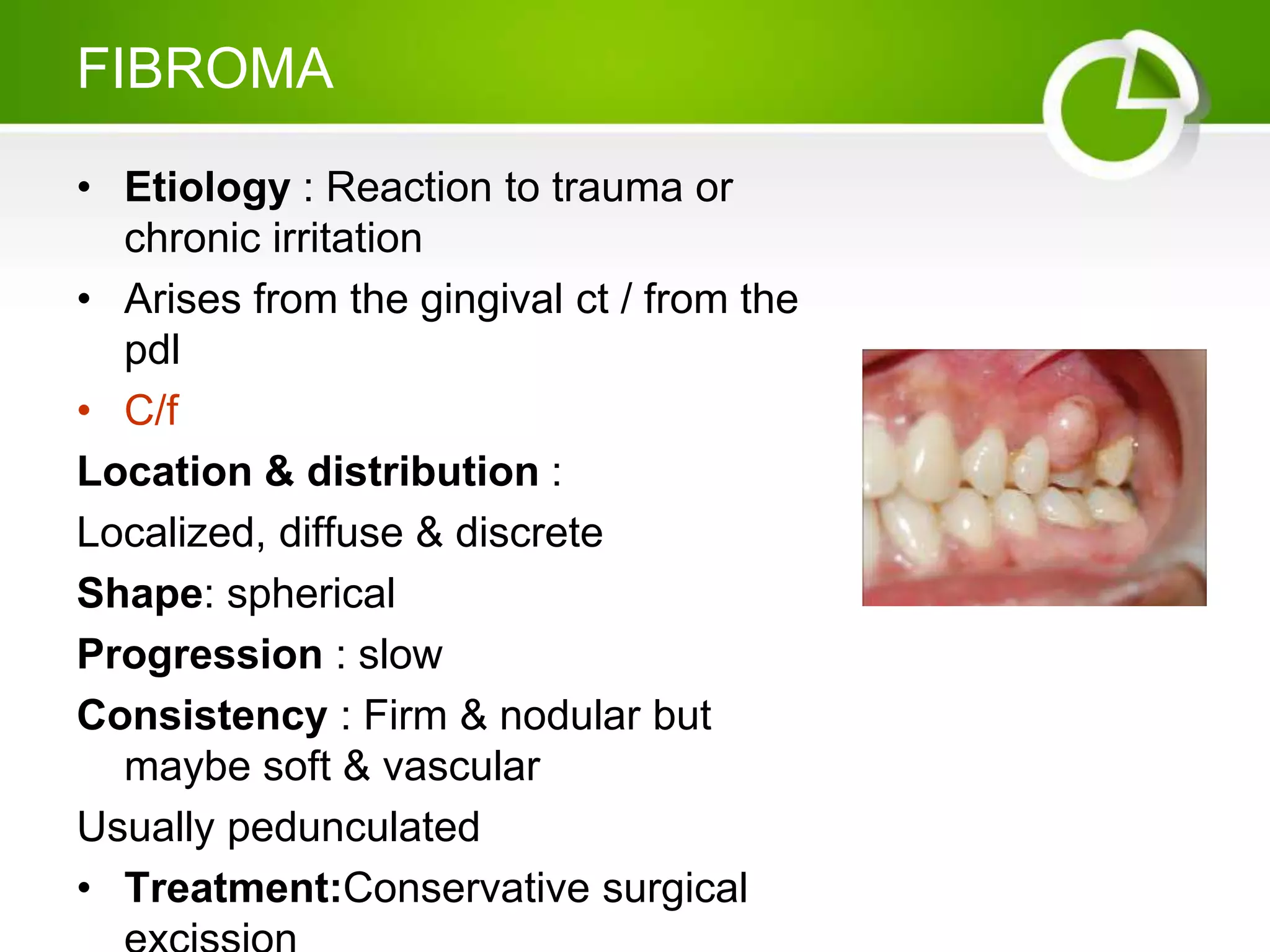 Gingival enlargement | PPTX