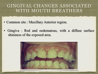 Gingival enlargement | PDF