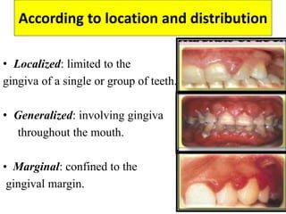 Gingival enlargement | PPTX