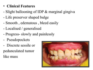Gingival enlargement | PPTX