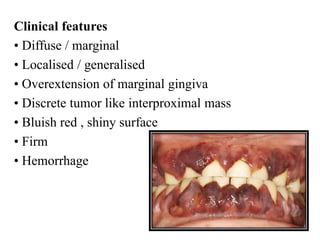 Gingival enlargement | PPTX
