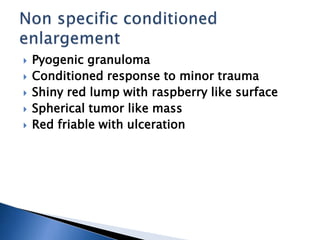 Gingival enlargement | PPTX