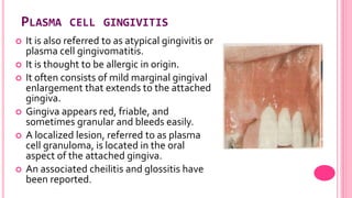 Gingival enlargement | PPTX