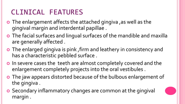 Gingival enlargement | PPT
