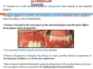 Gingival enlargement | PPTX