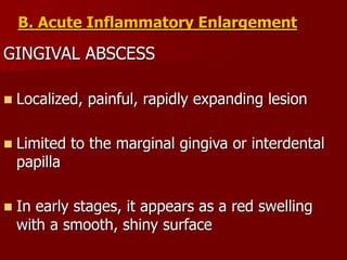 Gingival Enlargement.ppt