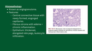 Gingival Enlargement Periodontology Persentaty | PDF