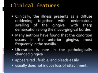 Gingival Enlargement- II.pp