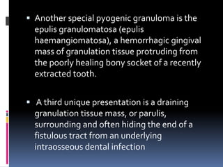 Gingival Enlargement- II.pp