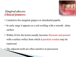 gingival enlargement 12.pptx department of periodontics | PPTX