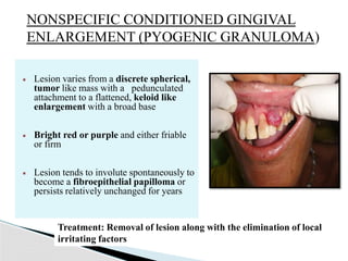 gingival enlargement 12.pptx department of periodontics | PPTX