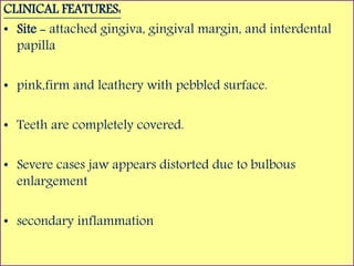 "GINGIVAL-ENLARGEMENT" | PPTX