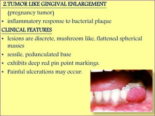 "GINGIVAL-ENLARGEMENT" | PPTX
