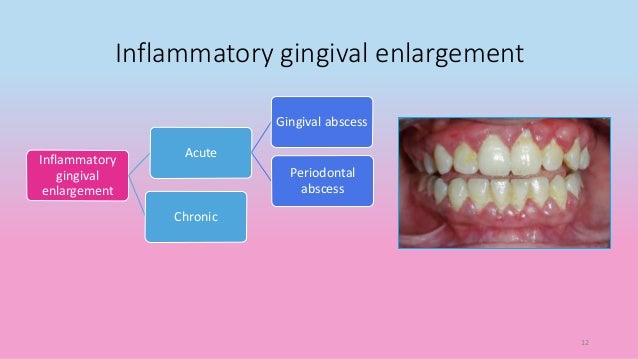 GINGIVAL ENLARGEMENT: PART-1 AND PART-2