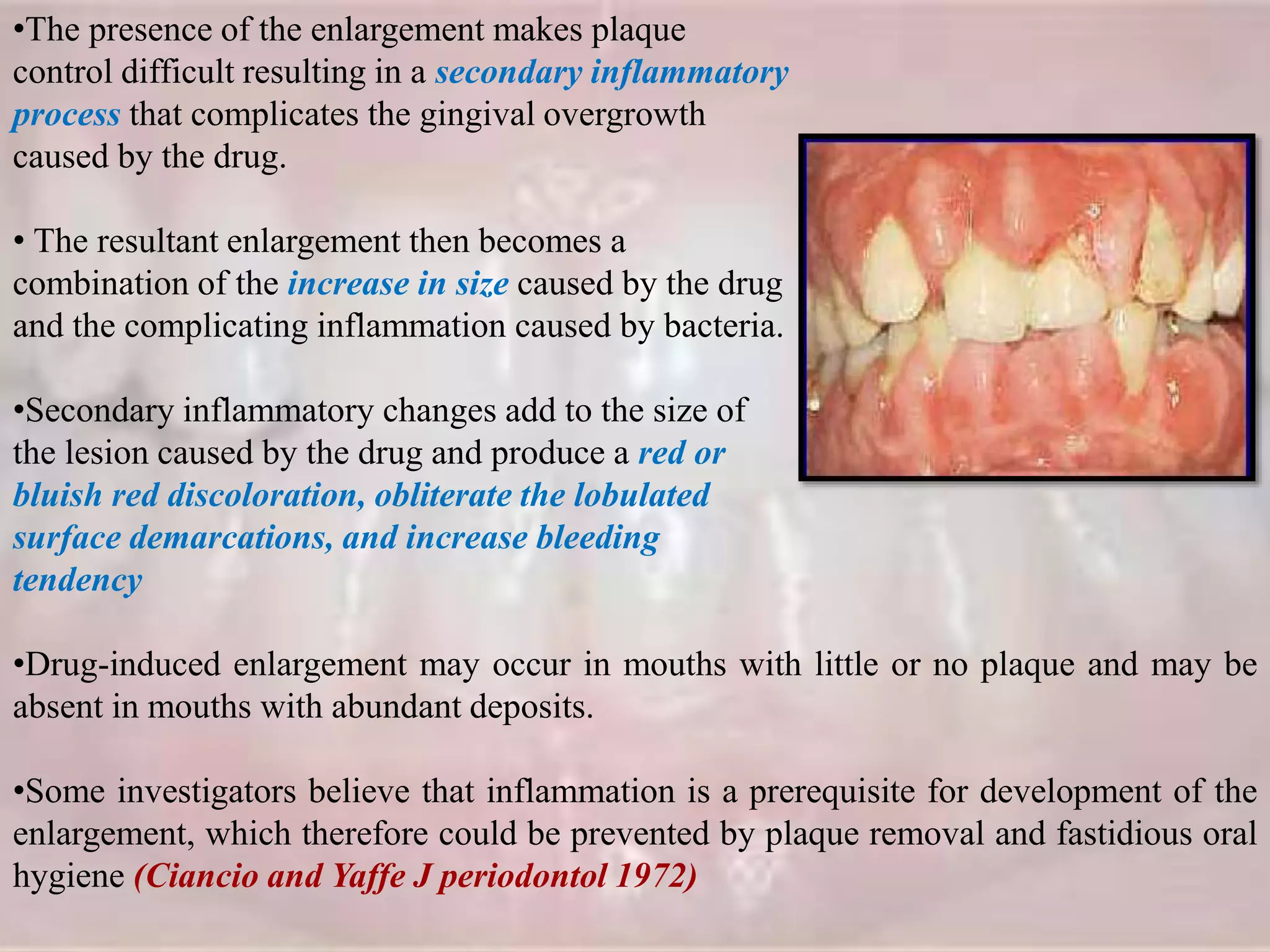 Gingival enlargment and its treatment | PPTX