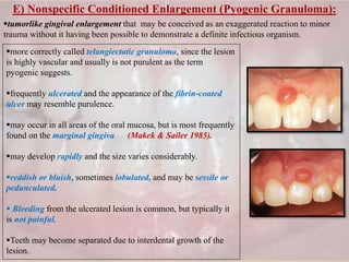 Gingival enlargment and its treatment | PPTX