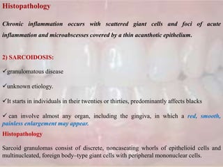 Gingival enlargment and its treatment | PPTX