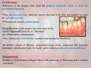 Gingival enlargment and its treatment | PPTX